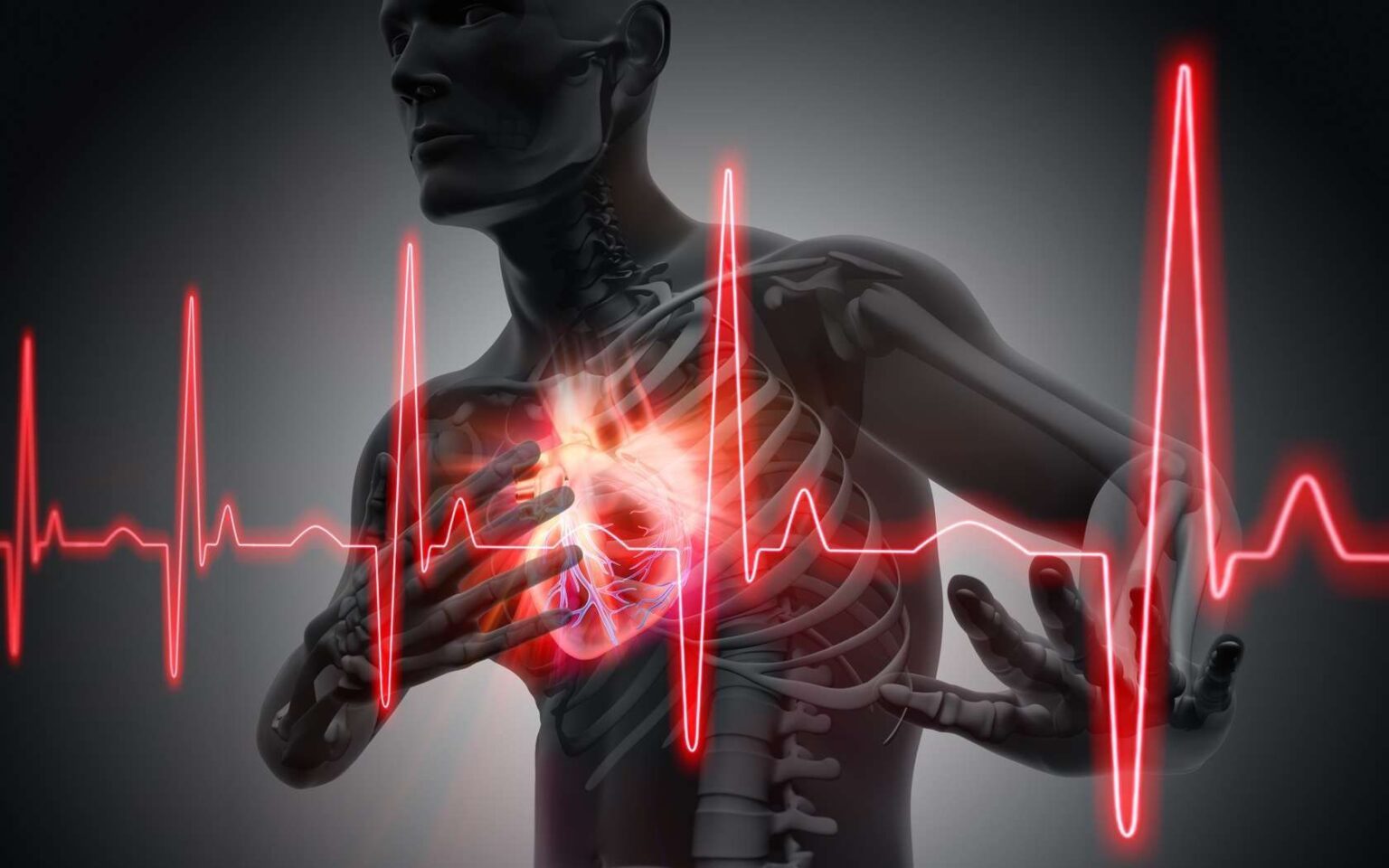 EKG - infarkt miokarda - Interna Medicina - Moja Medicina