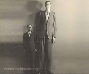 Šta je gigantizam? - Patološka fiziologija - Moja Medicina