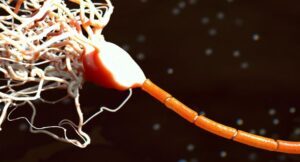 Šta je mijelin (mijelinski omotač) - Moja Medicina